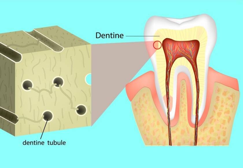 Understanding Tooth Sensitivity: Causes, Symptoms, and Treatment ...